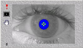 Synapsys - VIDEO NYSTAGMOGRAPHY